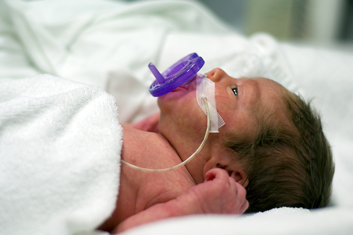 Premature Birth Complications: 12 Short And Long Term Risks