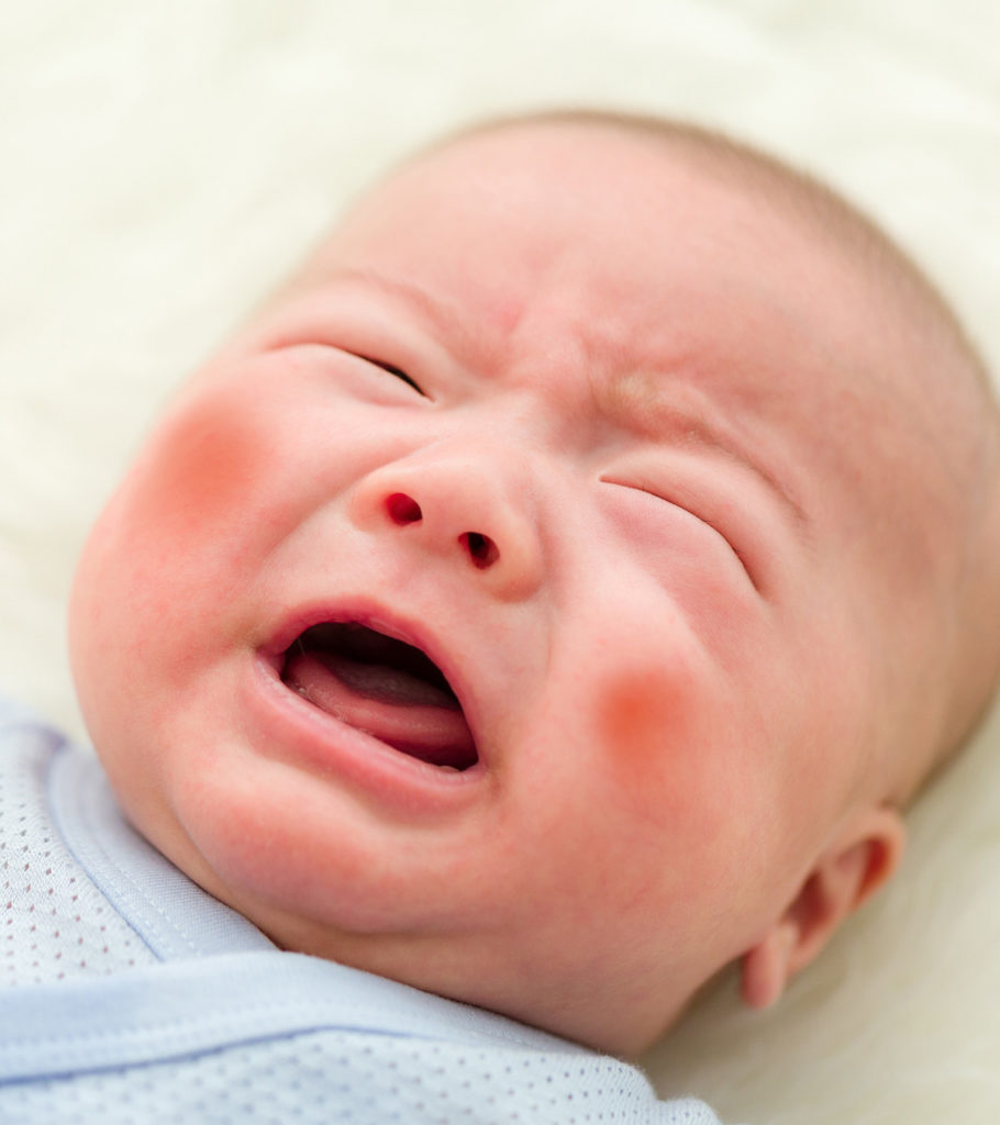 Bruises In Babies And Children: What You Need To Know
