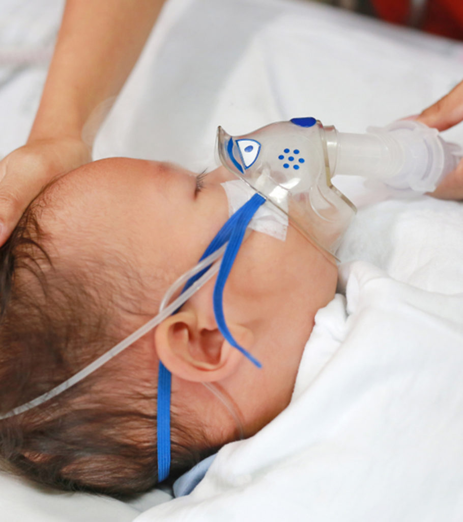RSV In Babies: Signs, Symptoms, Causes, Diagnosis & Treatment